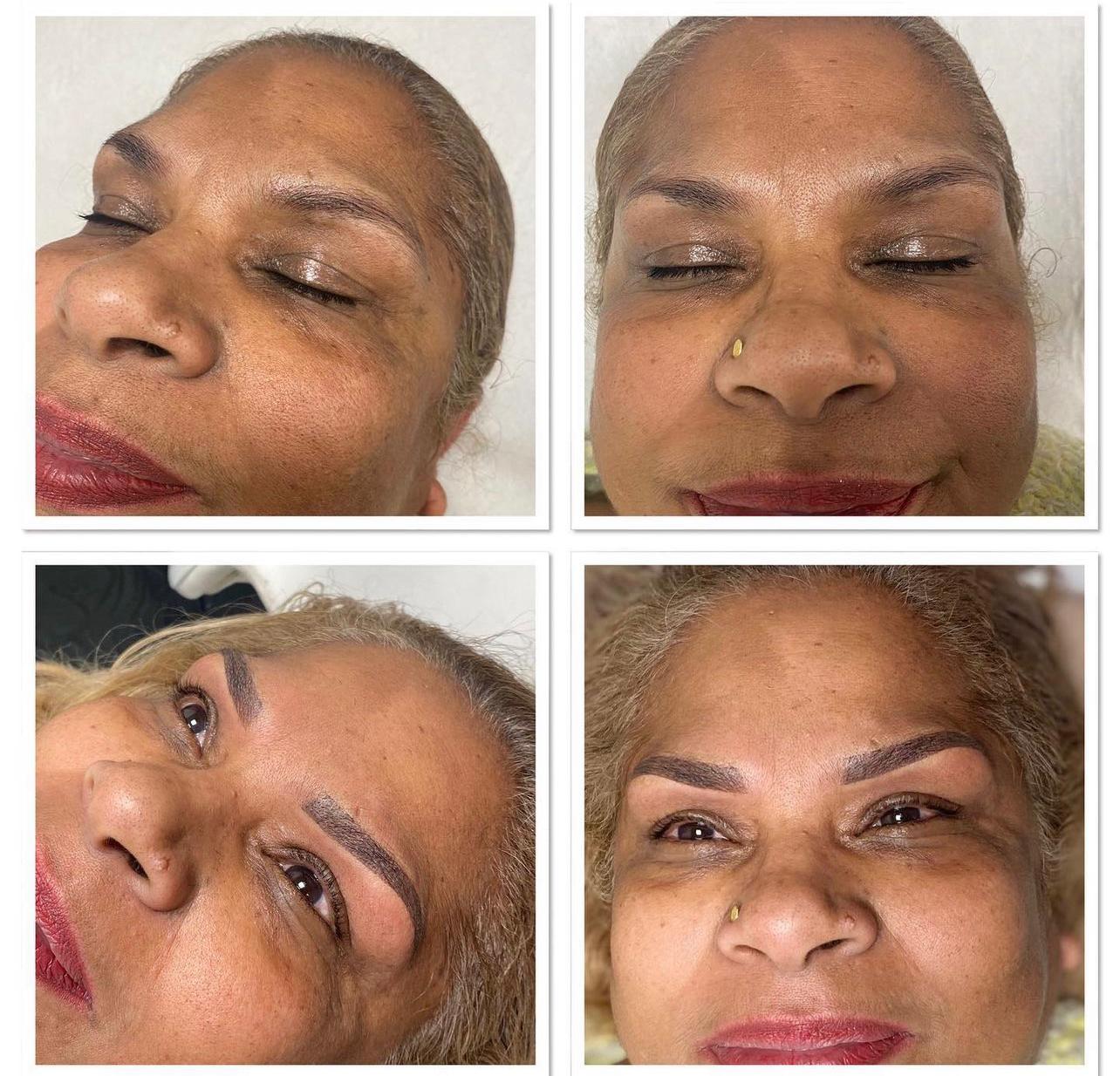 Spmu Eyebrows Powder Technique - Royal Dutch Clinic